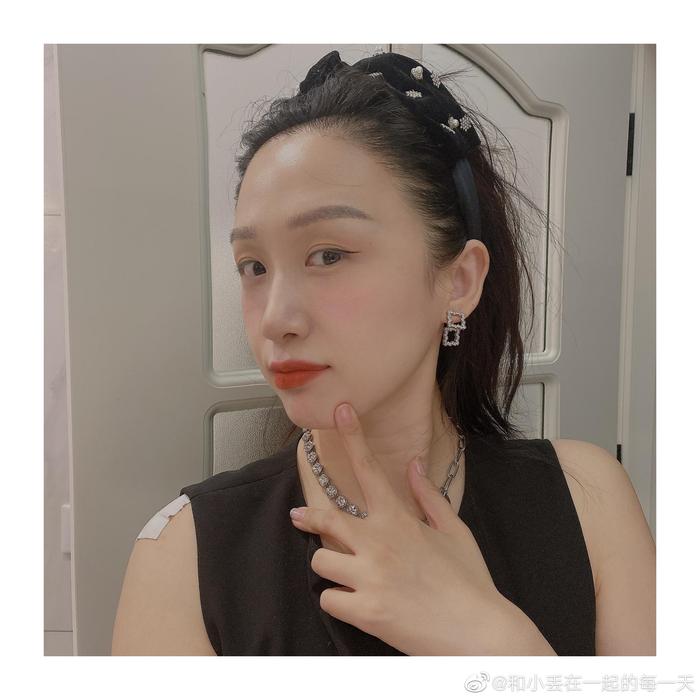 偷偷做皮秒了 但是觉得除了几个小晒斑的效果 整体来说