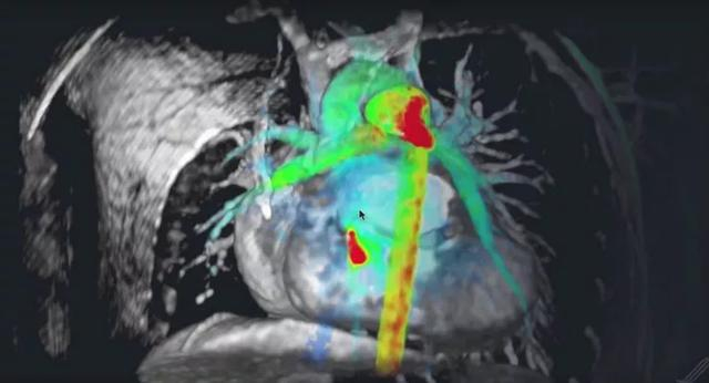 AI助力 4D 核磁共振扫描，数据处理速度提高 30 倍！
