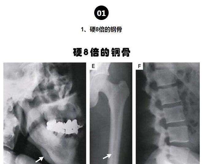 罕见的身体特征：只有少数人身上才拥有的10个罕见的特征