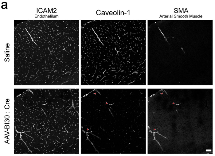 Nat Cardiovasc Res：只想标记/操控CNS内皮细胞？AAV-BI30高效助力！