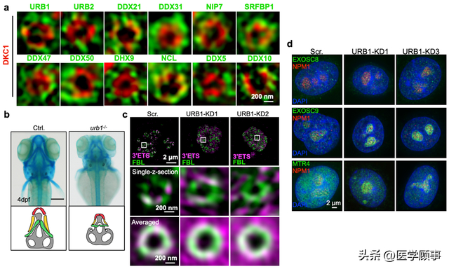 《自然》：揭示核仁精细结构，破解关键核仁蛋白的作用