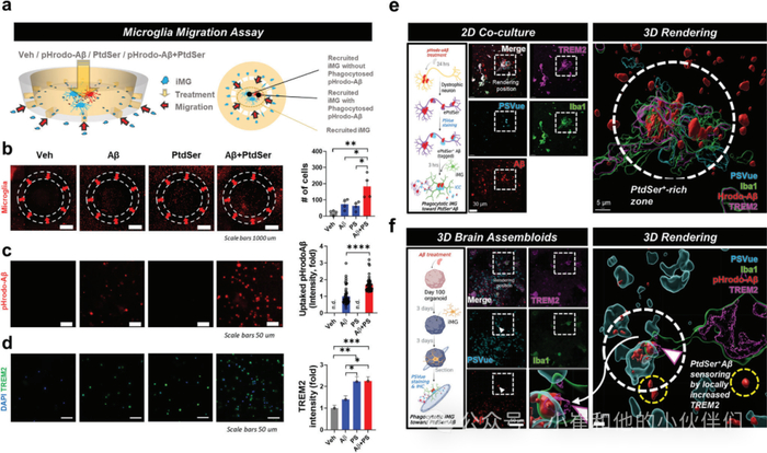 Adv Sci：小胶质细胞通过TREM2被外部磷脂酰丝氨酸包围的Aβ吸引