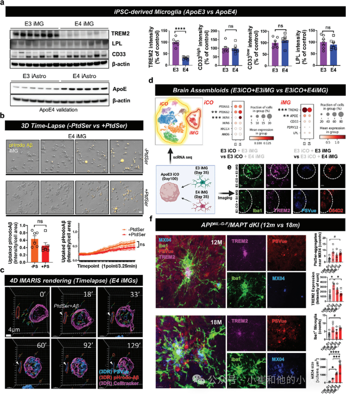 Adv Sci：小胶质细胞通过TREM2被外部磷脂酰丝氨酸包围的Aβ吸引