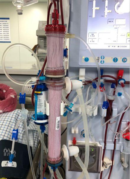 喜讯！河南圣德医院血液净化中心已成熟开展HFR血液净化技术！