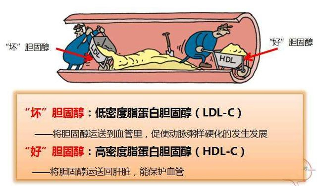 低密度脂蛋白高？坚持做这4件事，7.2降到2.3，只要1个月|脂蛋白|低密度|胆固醇_新浪新闻