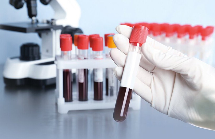 依库珠单抗生物类似药Epysqli获得FDA批准，用于治疗PNH和aHUS__财经头条__新浪财经