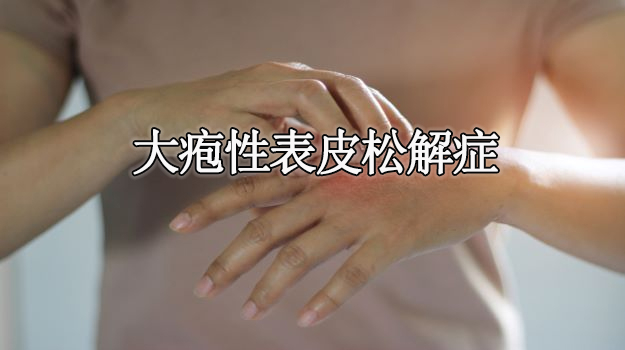 首个大疱性表皮松解症伤口疗法！欧盟批准Filsuvez(Oleogel-S10)
