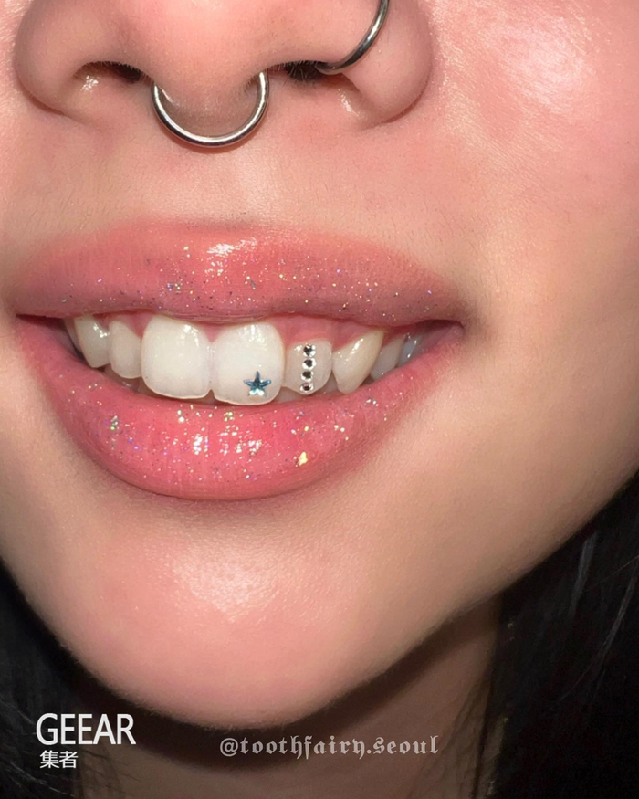 Lisa牙齿上闪闪发光的“东西”，它正在韩国掀起热潮！|牙齿|韩国|宝石_新浪新闻