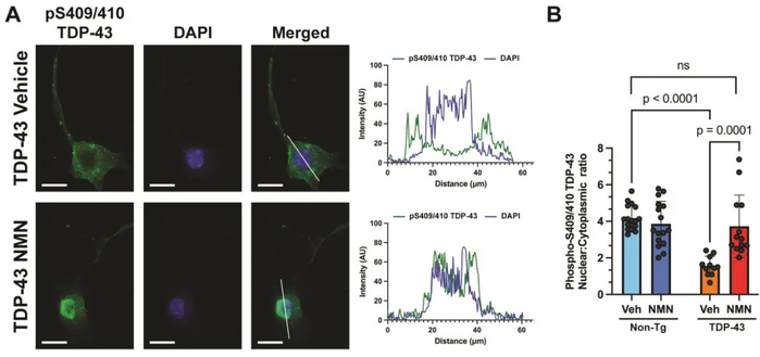ALS福音！新研究成果：NMN可以直接作用于运动神经元