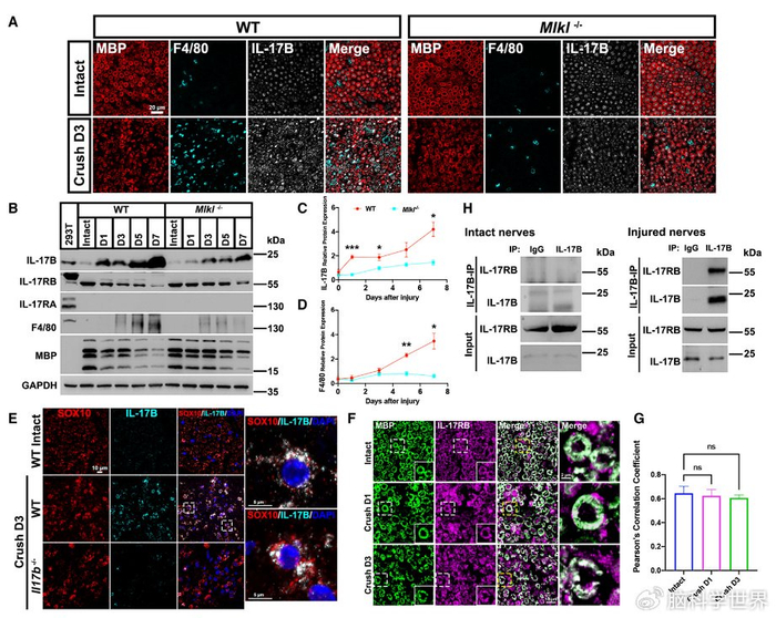 Cell Rep：在受损外周神经中雪旺细胞通过IL-17B/IL-17RB途径促进巨噬