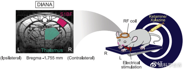 Science重磅研究：高时空分辨率的MRI成像|生物学与医学|脑科学|rain|丘脑|神经元_新浪新闻