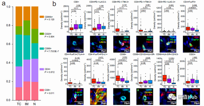 沈琳教授团队发现新型胃癌免疫治疗疗效预测标志物|细胞|免疫|巨噬细胞_新浪新闻