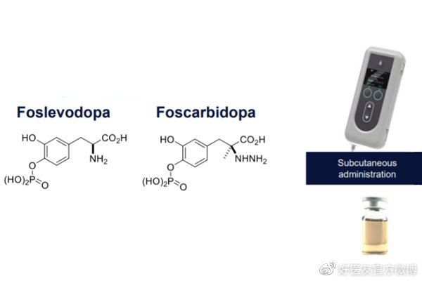 一周改善，持续稳定3个月！新疗法有望打破帕金森治疗困局|帕金森|左旋多巴|卡比多巴_新浪新闻