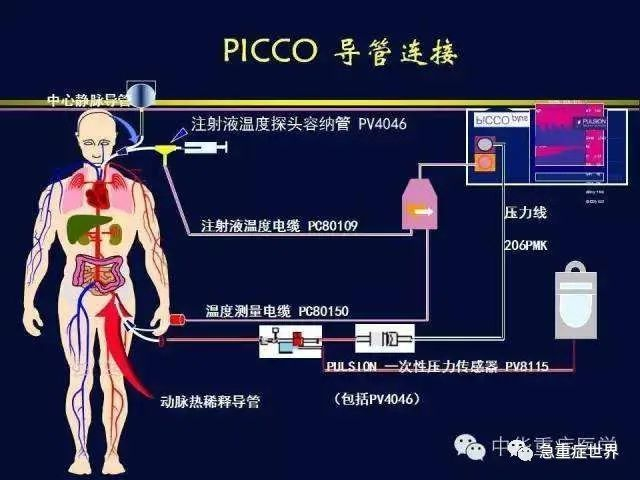 PICCO的各项参数意义，您都知道吗？|肺部疾病|血管|输出量|分析法|心舒_新浪新闻