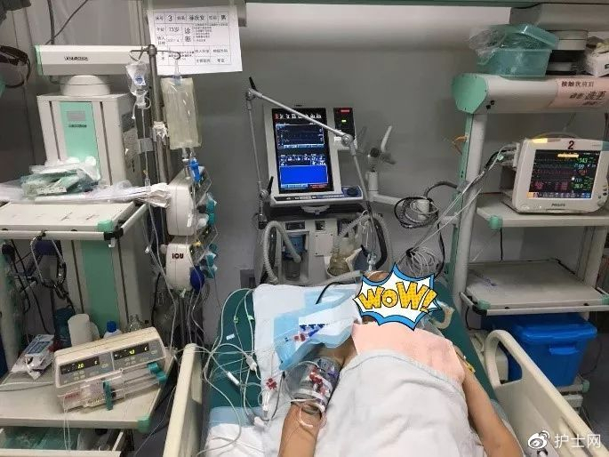 实用！ICU气管插管的护理知多少？