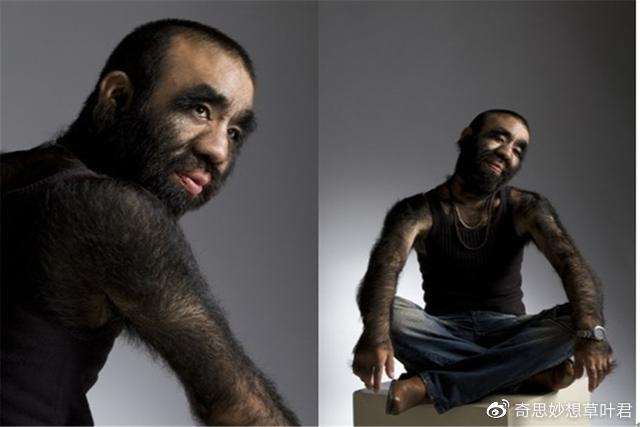 人类消失的“尾巴”！日本发明仿生尾巴，返祖现象究竟是退化还是进化