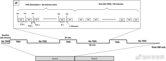 Frontiers in Neurosci: 重复经颅磁刺激（rTMS）研究新进展|精神分裂症|中风|兴奋性_新浪新闻
