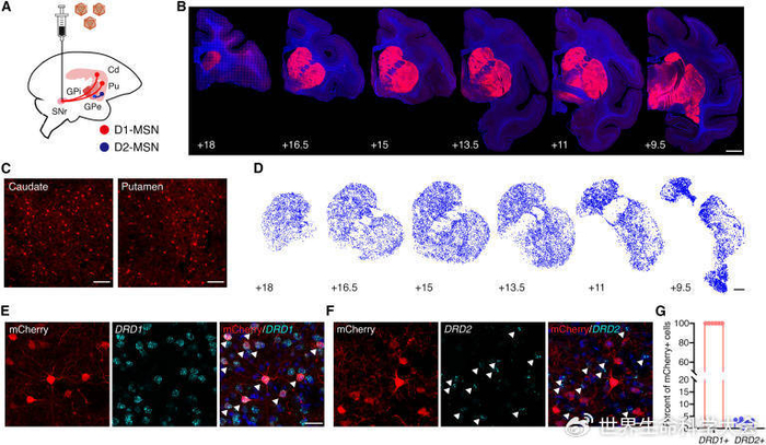 Cell丨基因治疗帕金森，精确激活 D1-MSN，逆转病理模型的核心症状__财经头条