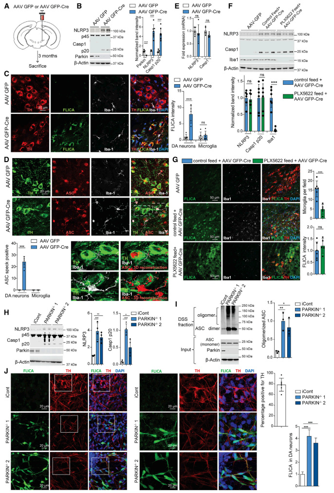 Neuron：神经元NLRP3是帕金森病中驱动神经退变的Parkin底物|神经元|小鼠|底物_新浪新闻