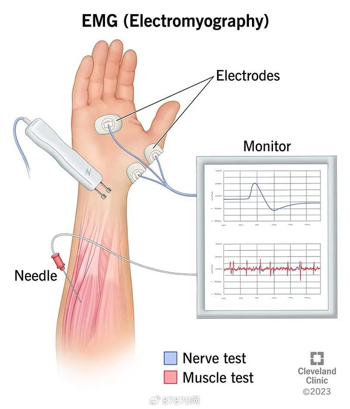 Nature顶刊发布，一文看懂Meta新技术“肌电手环sEMG”__财经头条__新浪财经