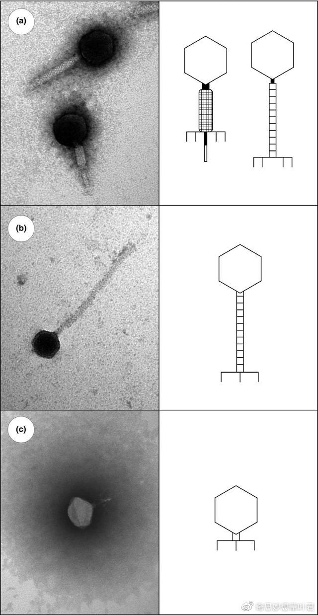 比抗生素更好用！对超级细菌有奇效的噬菌体，为何市场上见不到？