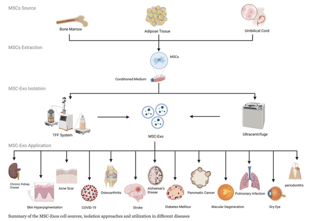 科学研究实锤！间充质干细胞外泌体有潜力治疗糖尿病、癌症等疾病