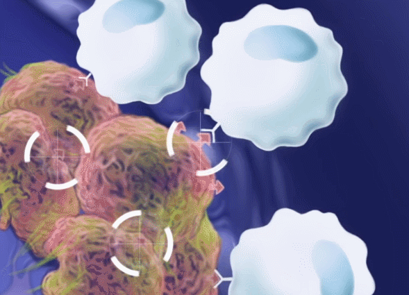 国内又一名胃癌患者受益！CAR‑T 疗法有望作为实体瘤的潜在治疗选择