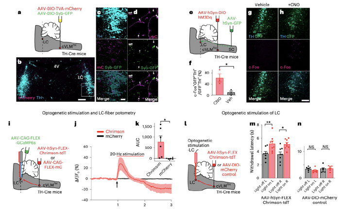 Nature Neurosci：疼痛调控新神经环路