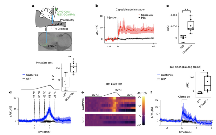 Nature Neurosci：疼痛调控新神经环路