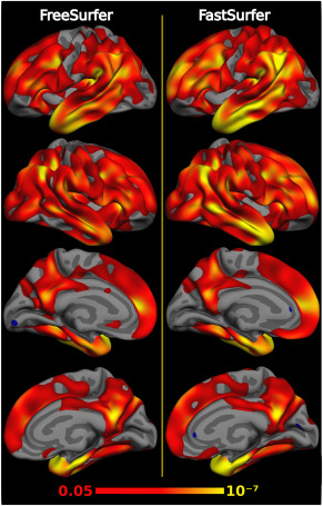 FastSurfer深度学习脑部成像工具：1分钟脑部分割，1小时皮质重建！_手机新浪网