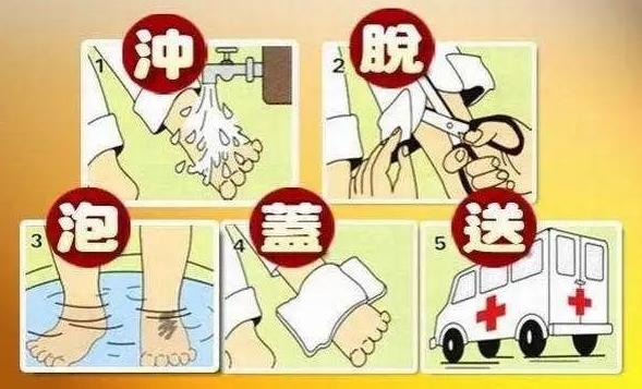 孩子烫伤了该如何处理？只需记住五个字，其他方法都会耽误事|烫伤|小儿|烫伤者_新浪新闻