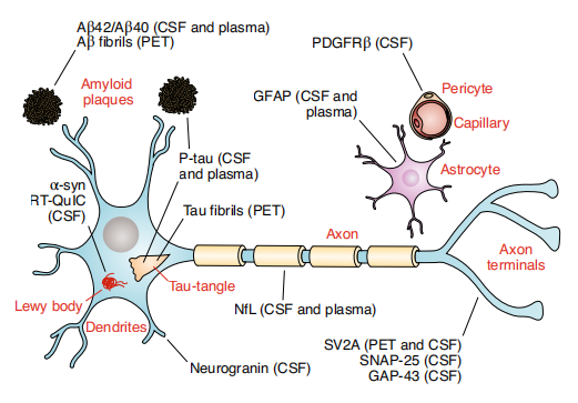 Nat Med 综述：神经退行性疾病的标记物|生物|PET_新浪新闻