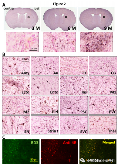 Brain:一种内源性的新tau小鼠模型