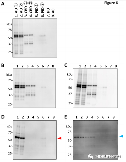 Brain:一种内源性的新tau小鼠模型