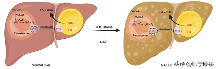 过氧化物酶体β-氧化作为细胞内脂肪酸的传感器并调节脂肪分解