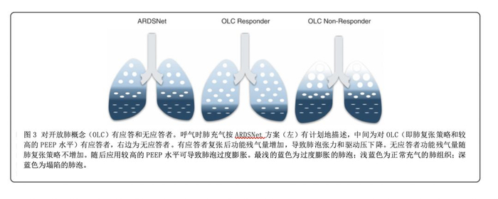 ARDS患者的肺开放概念：肺复张和高PEEP