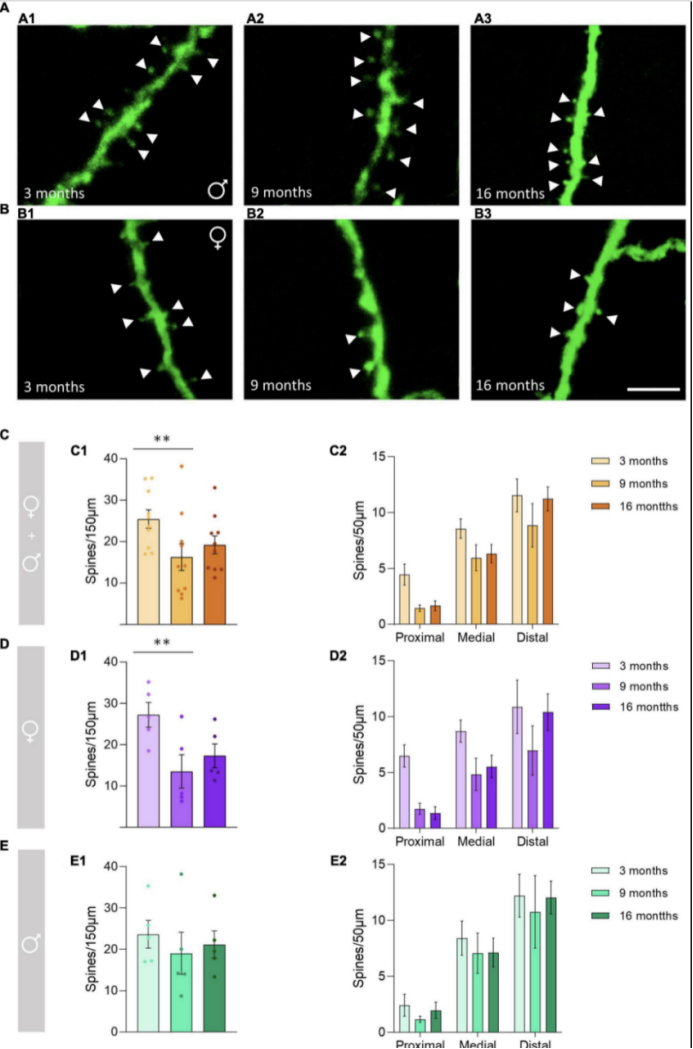 Front.aging.neurosci- 衰老对小鼠海马神经元NMDA的影响|神经元|树突棘|海马_新浪新闻