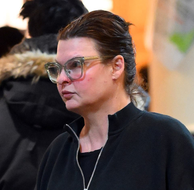 超模琳达因溶脂导致毁容后罕见现身，面部肿胀变形，判若两人