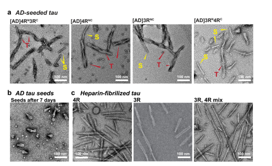 Nature 子刊：两种不同类型的tau蛋白的混合及形成结缠的内在机制__财经头条