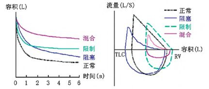 读懂肺功能报告单，看这篇文章就够了！