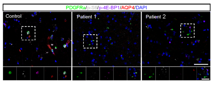 Glia：邱伟/汤常永团队报道NMOSD受损神经再生修复的潜在治疗策略|论文_新浪新闻