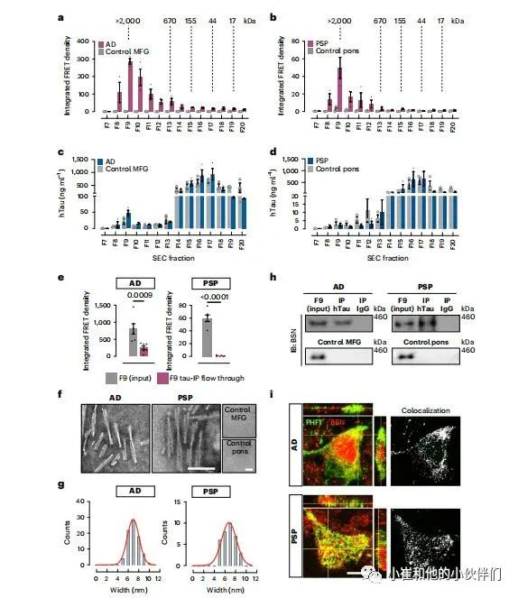 Nature Neurosci：一种有助于tau种子繁殖和神经毒性的蛋白|突触_新浪新闻