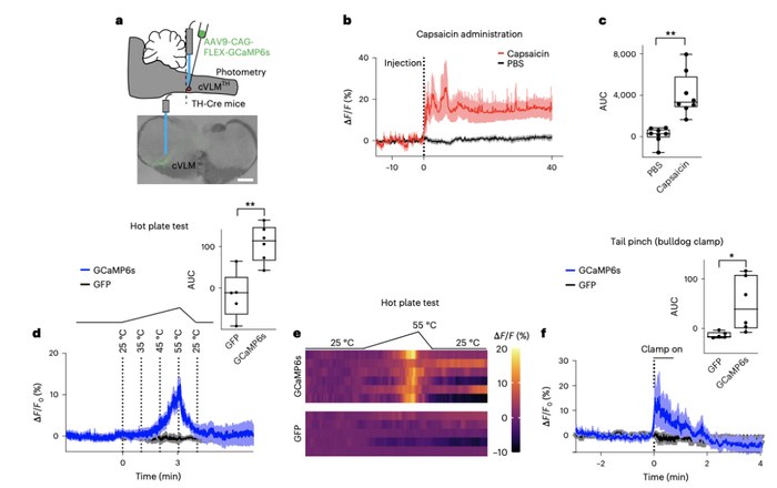 Nature Neurosci：疼痛调控新神经环路