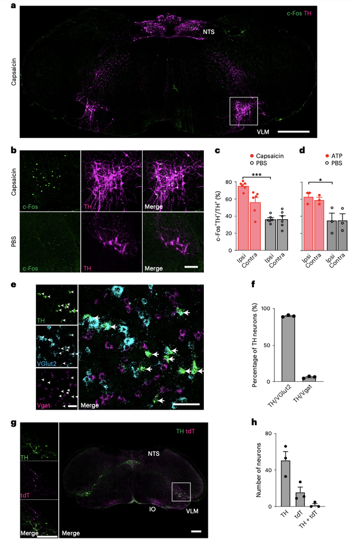 Nature Neurosci：疼痛调控新神经环路|遗传学|化学_新浪新闻