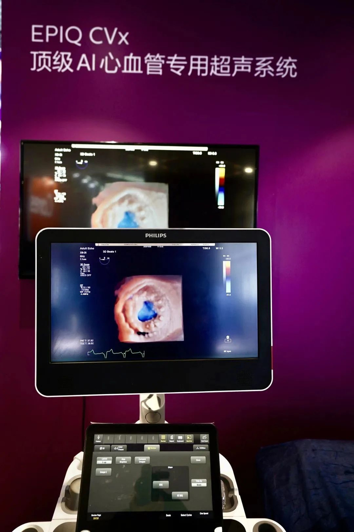 直击临床痛点，CMEF飞利浦交出本土化“新答卷”！__财经头条__新浪财经