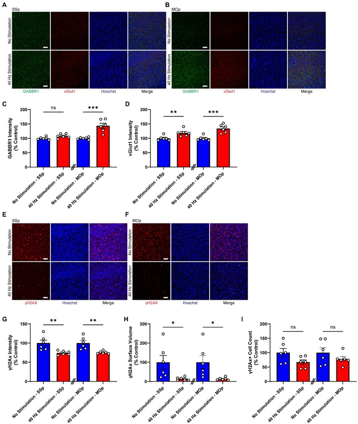 MIT蔡立慧团队最新报道40Hz震动刺激改善AD病理和运动表现|MIT_新浪新闻