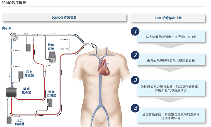 沙利文发布《ECMO行业现状与发展趋势报告》（内附全文获取方式）__财经头条__新浪财经