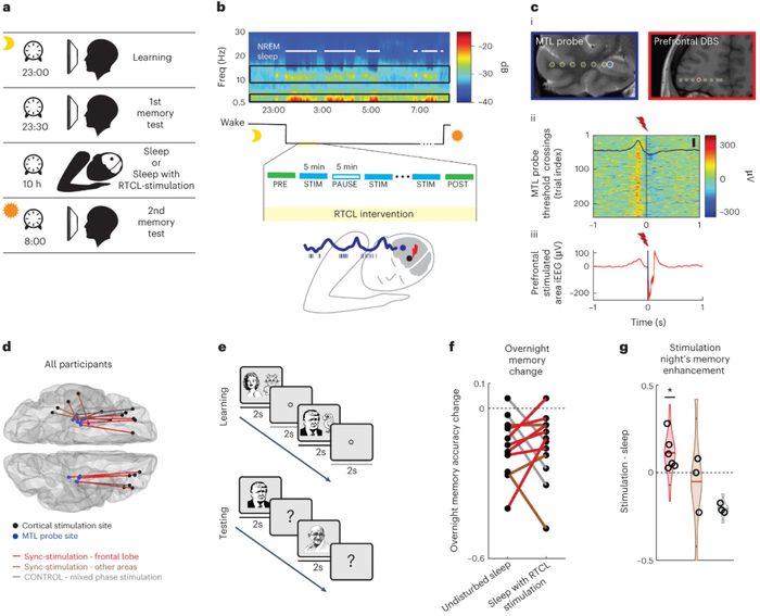 6.6 脑科学日报| Nat Neurosci：睡眠期间的深部脑刺激可以增强记忆