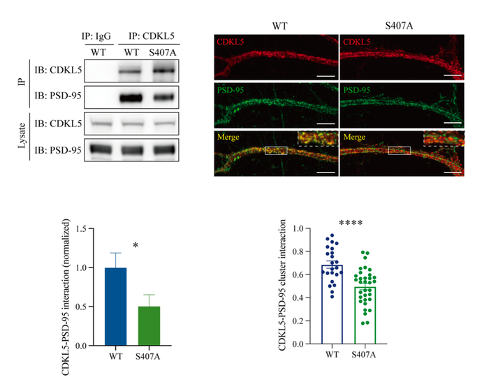 NB：熊志奇团队最新研究为CDD的神经生物学机制提供了新的视角