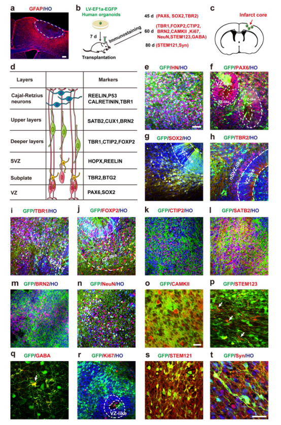 NPJ Regen Med：朱东亚/刘妍团队利用人脑类器官移植修复脑卒中损伤